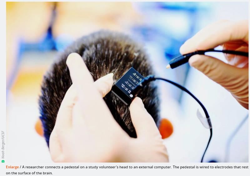 arstechnica - AI-powered brain implants help paralyzed patients communicate faster than ever ...