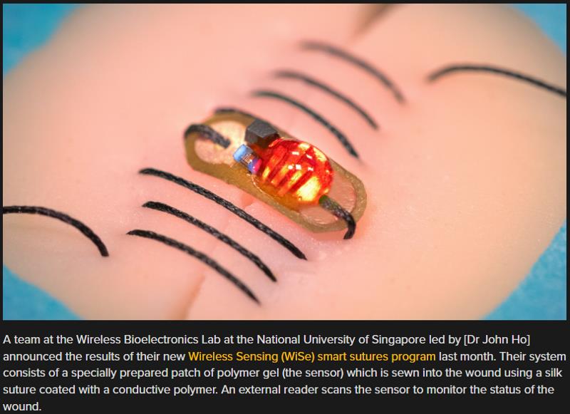 hackaday - Smart Sutures Become WiSe - Arfy'z tranche du Net
